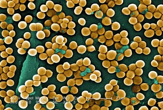 Протеинът от майчиното мляко може да помогне в борбата със Superbug