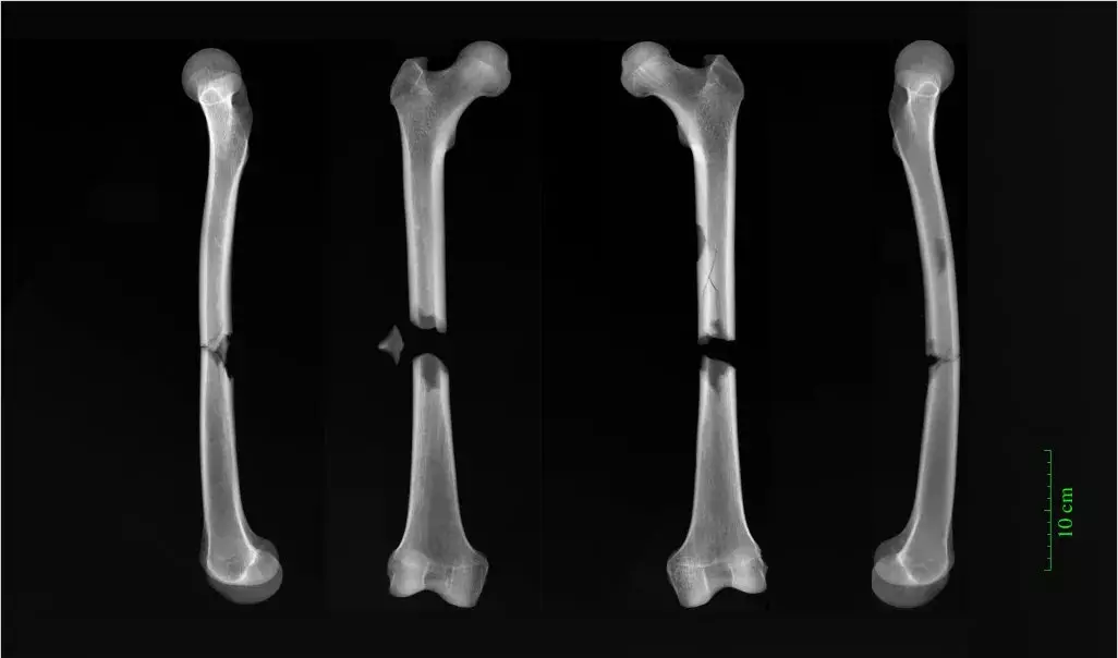Średniowieczne szczątki Brytyjczyków odnotowują „traumę szkieletową” spowodowaną nierównością 35487_2