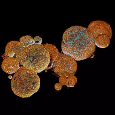 Organoid gwenwyn