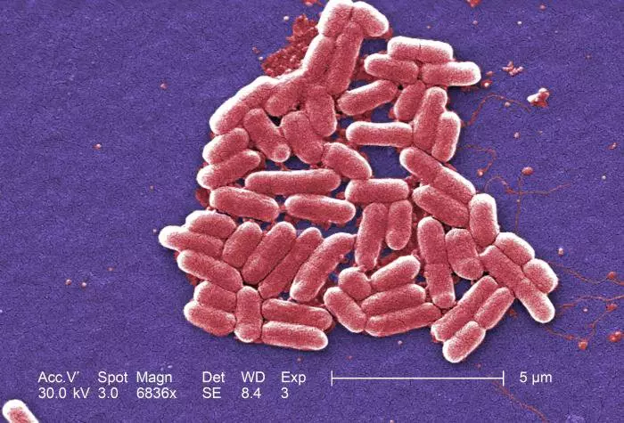 E. coli siama o loʻo faʻaalia i lalo ole microscope ile 6836X faʻateleina