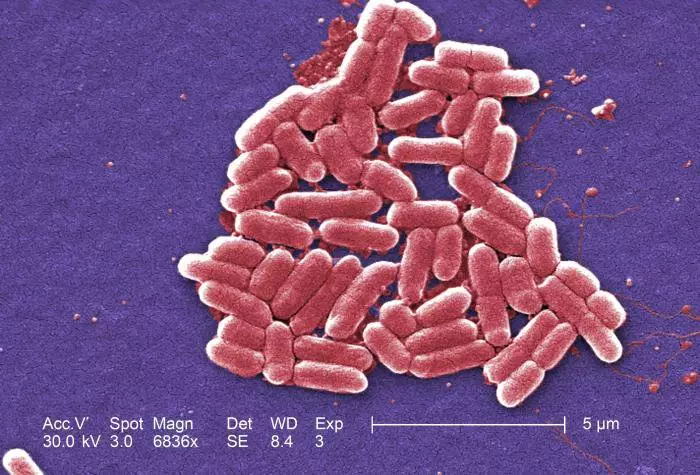 E. coli baktērijas parādītas mikroskopā ar 6836x palielinājumu