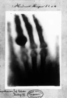 röntgensugarak
