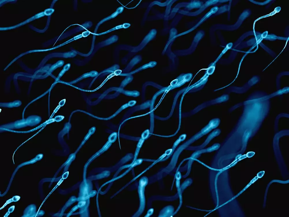 Da, numărul de spermatozoizi a scăzut constant, dar nu vă înghețați încă spermatozoizi