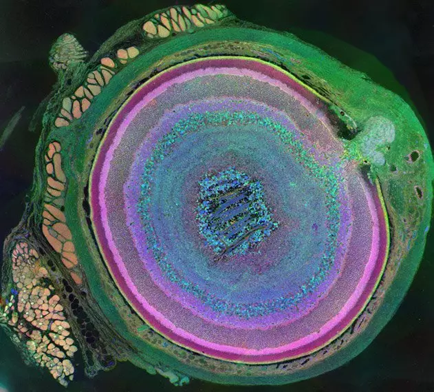 Qhov muag Metabolomic