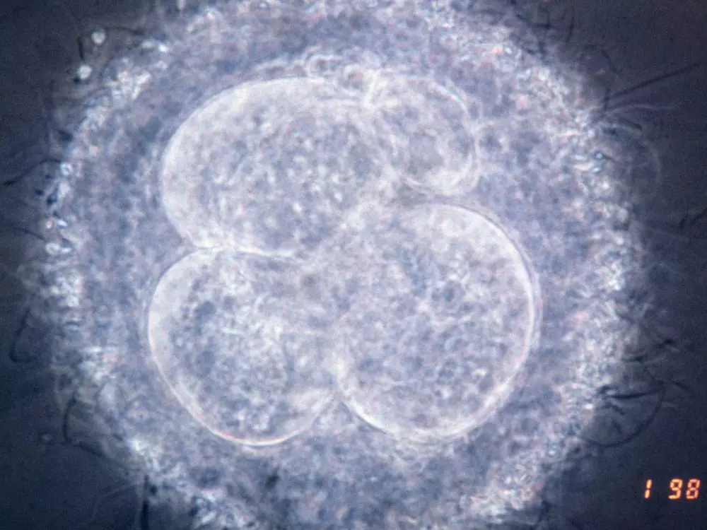 insan embrionu