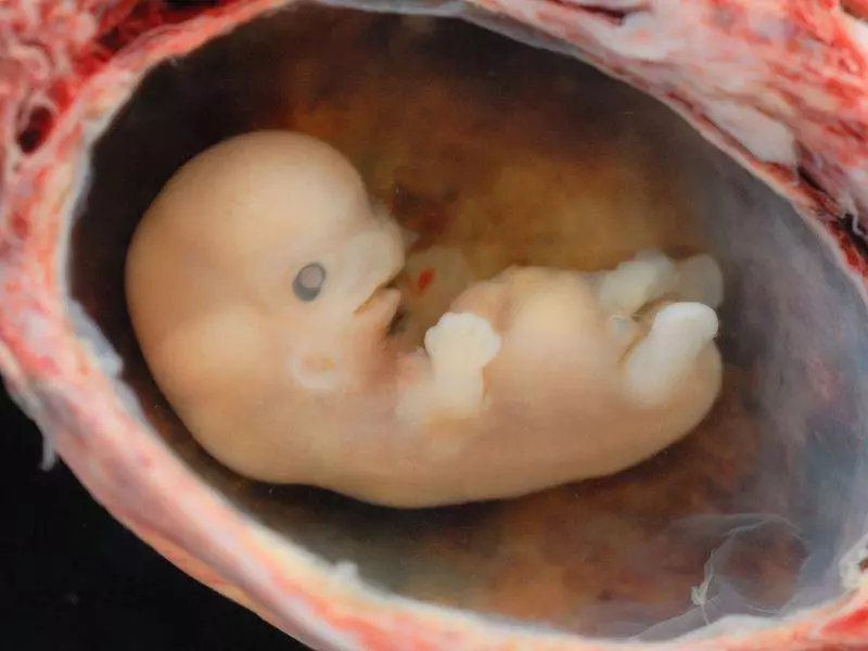 Embryo ຂອງມະນຸດ
