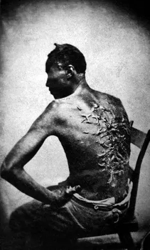 Amerikalı bir köle