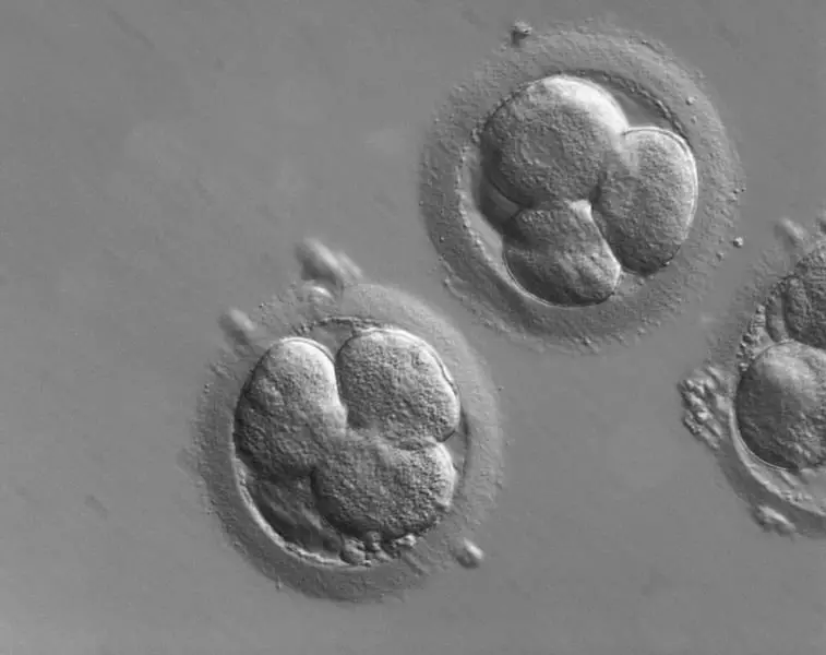 Cilvēka embriji