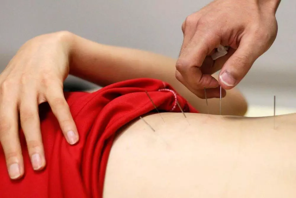 E South Koren Athlet kritt Akupunkturbehandlung