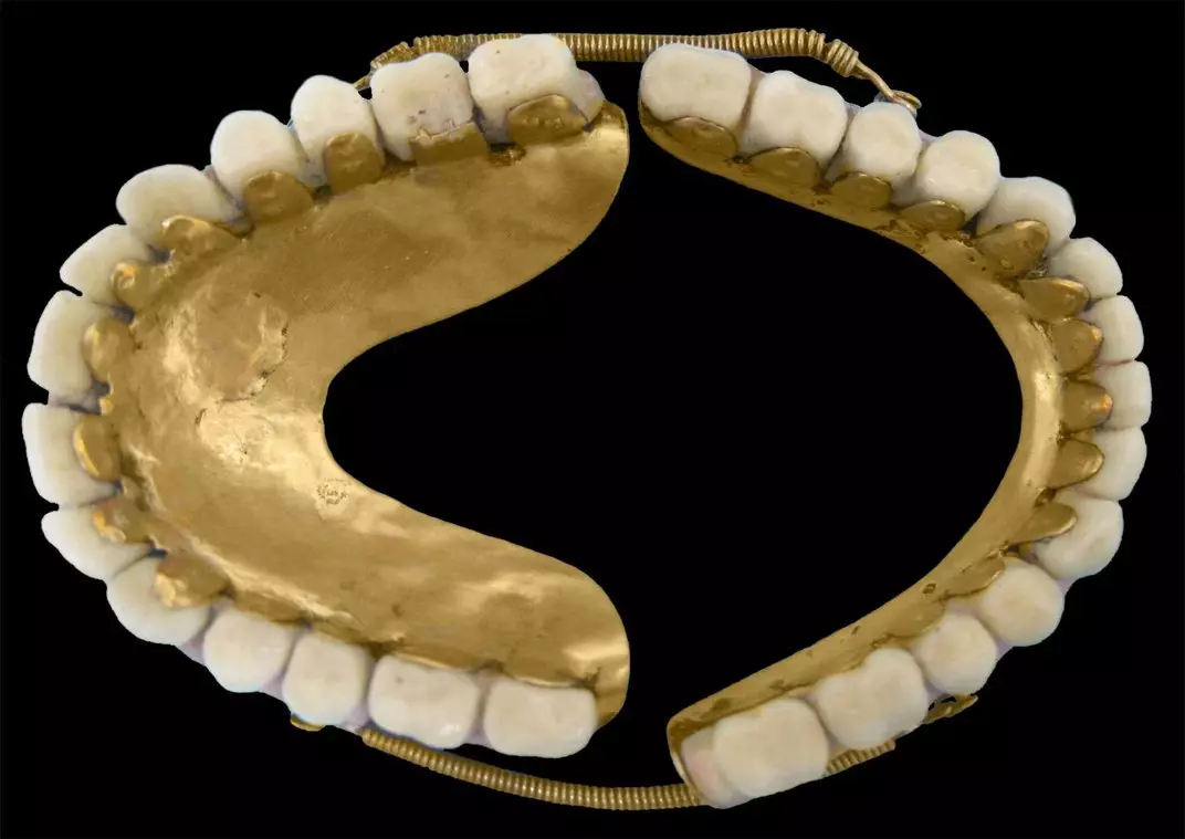 Ատամներից մինչև զուգարաններ, ոսկյա արտեֆակտների այս շլացուցիչ ցուցադրությունն ունի Midas Touch 42803_2