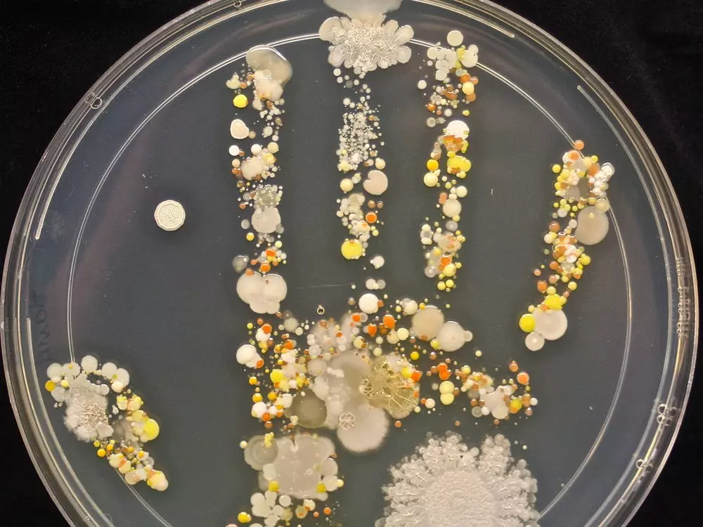 Ось що відбувається, коли ви культивуєте бактерії на руці восьмирічної дитини