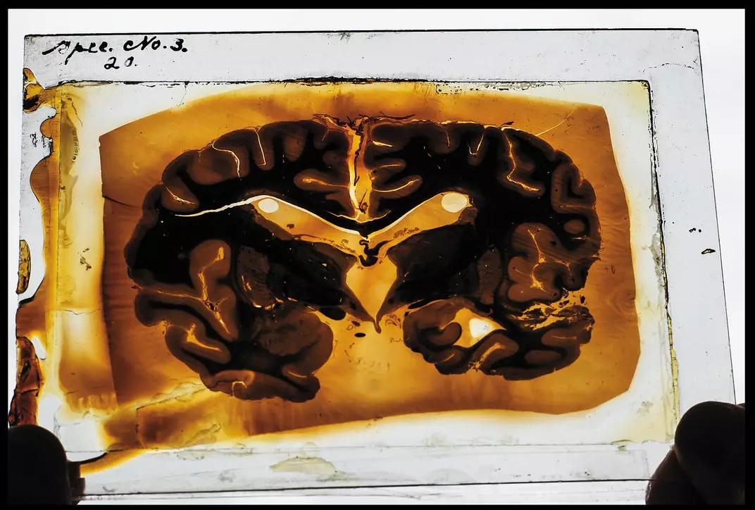 የእርስ በርስ ጦርነት ወታደሮች PTSD ነበራቸው? 50522_4