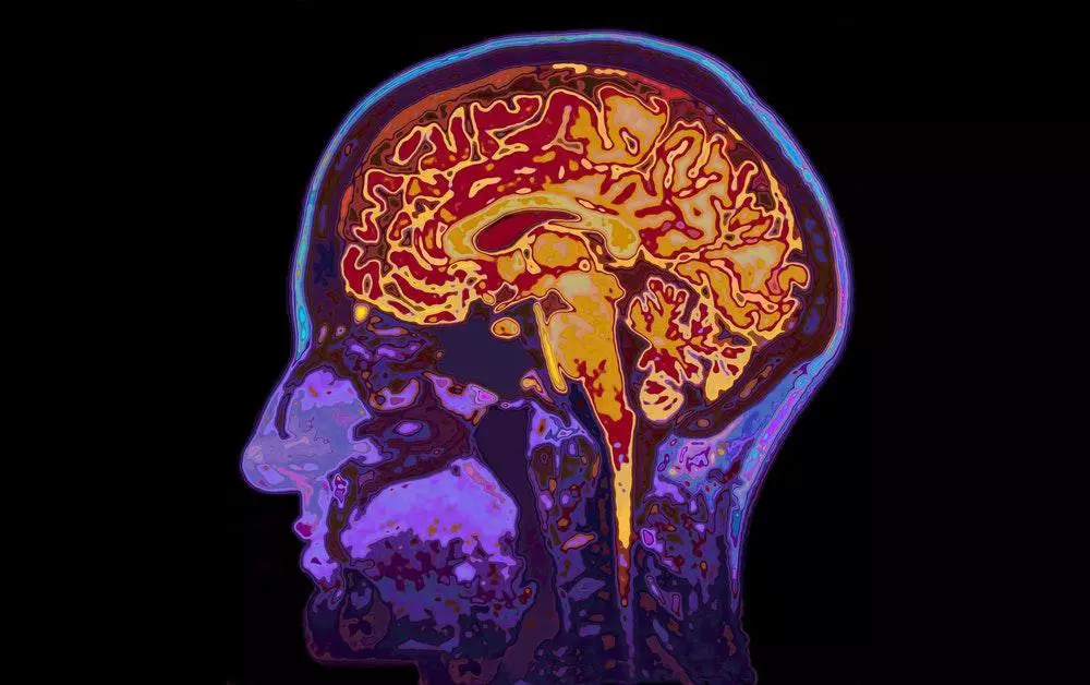 Может ли этот мозговой имплантат остановить приступы эпилепсии?