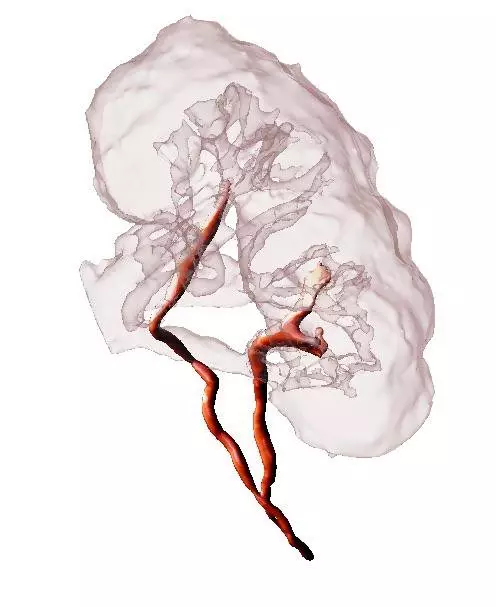 پزشکان می توانند مدل های پرینت سه بعدی اندام های شما را قبل از جراحی مطالعه کنند 51263_2