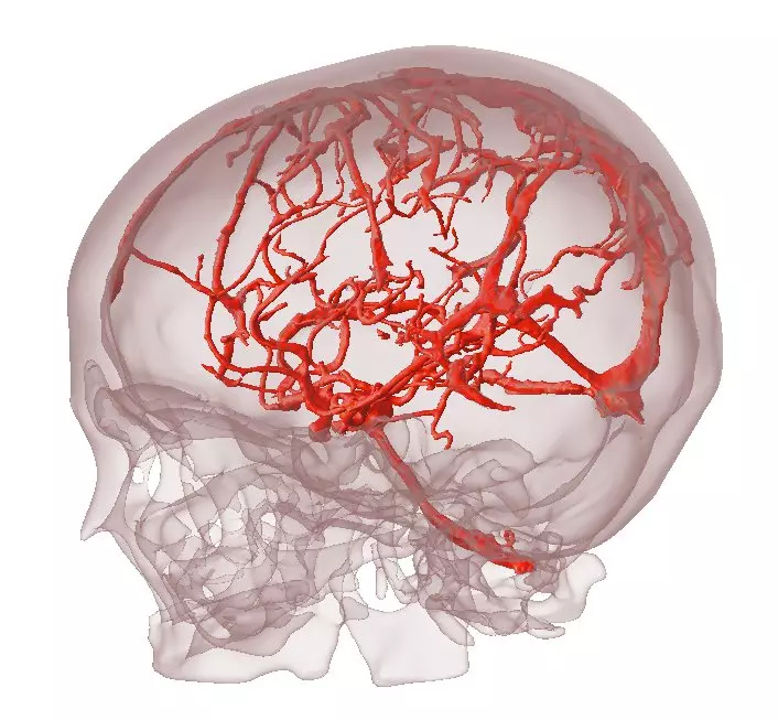 Dokter Bisa Diajar Model 3D Dicitak Organ Anjeun Sateuacan Bedah 51263_3