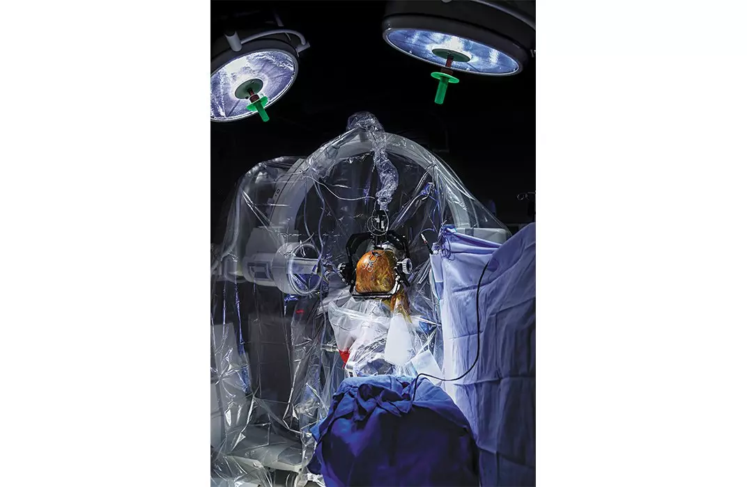 Zinātnē par pārsteidzošu jaunu ķirurģiju, ko sauc par dziļu smadzeņu stimulāciju 51394_4