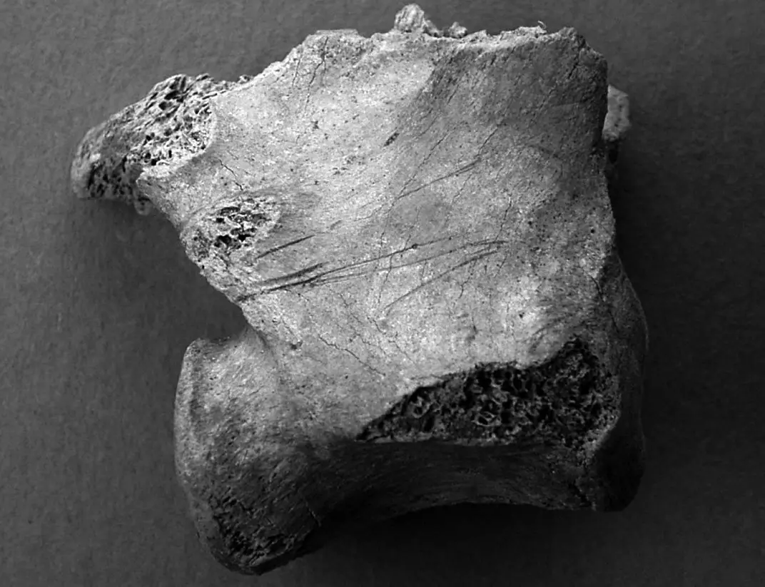 Umbono wamva we-lumbar vertebra