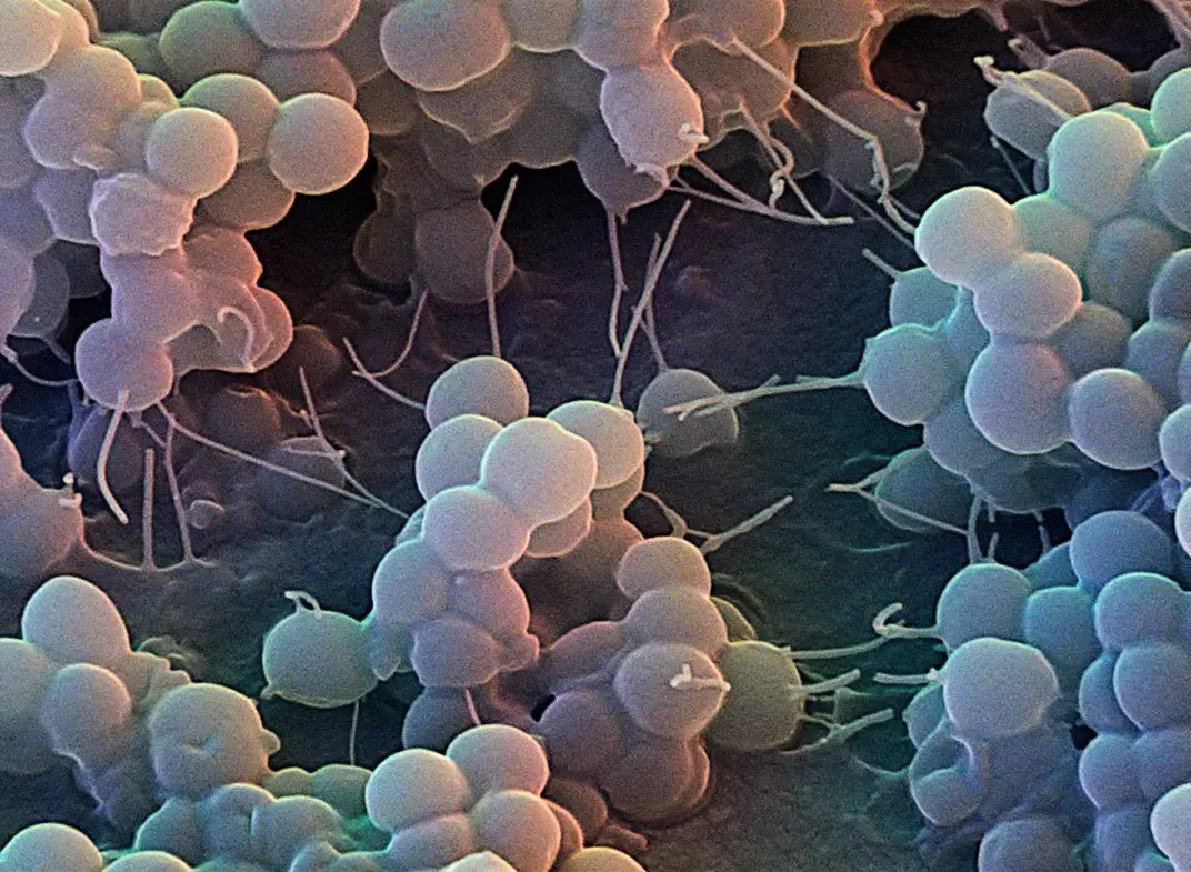 Ka ịkwụsị ịta anwụnta, mechie nje bacteria akpụkpọ gị