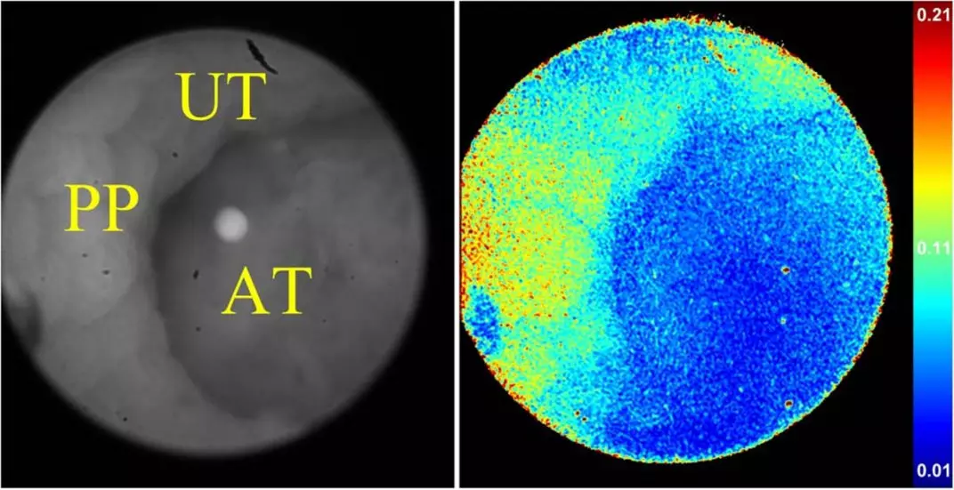 Polarized na imahe ng tumor sa colon ng mouse