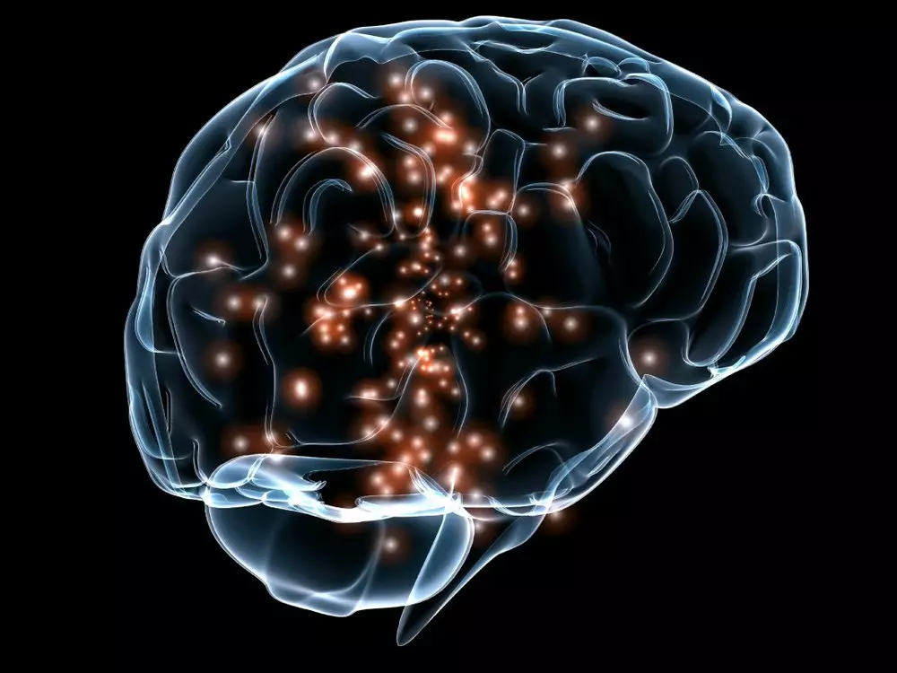 Чи можуть імплантати в мозку відновити пам'ять?