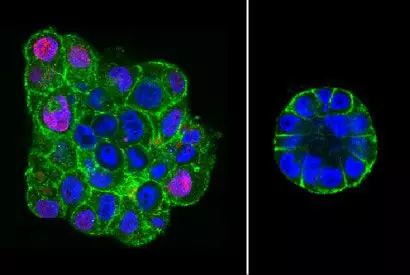稍微挤压乳房细胞可以阻止癌细胞的生长
