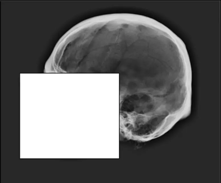 Зображення релізу черепа