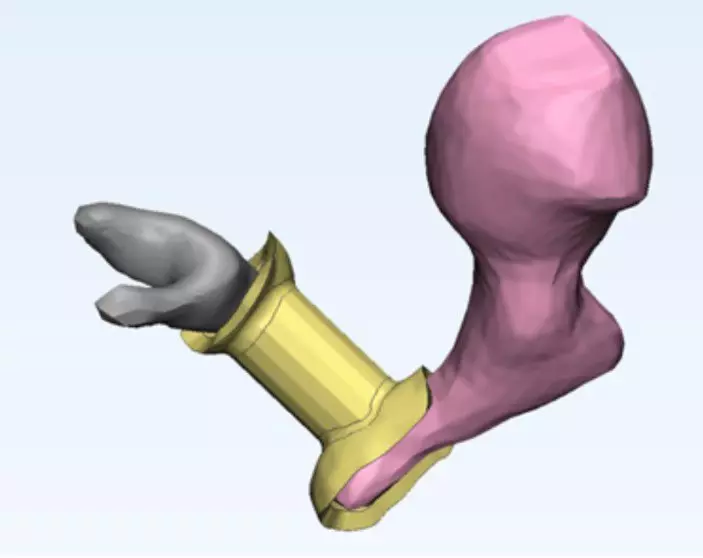Лекарите печатат 3D ушни коски за да помогнат при губење на слухот