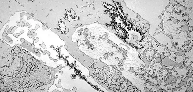Хүний хатаасан нулимсны микроскопийн бүтэц