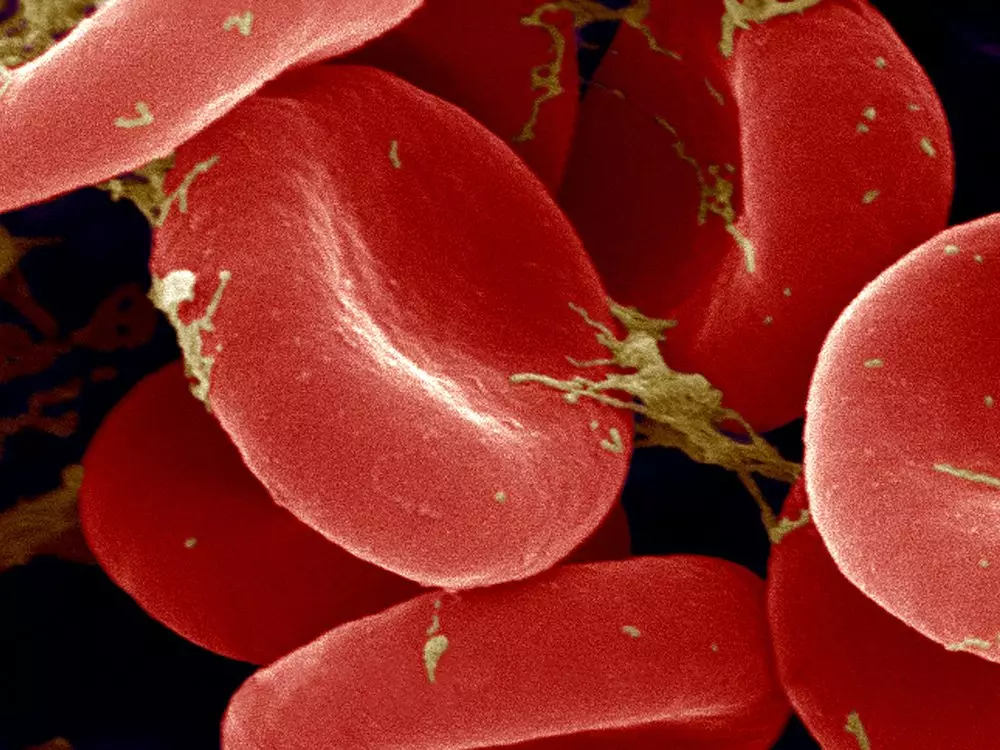 Bakteri Mbebayani Masquerade minangka Sel Darah Abang kanggo Nyingkiri Sistem Kekebalan